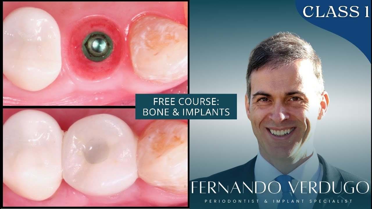Modern Implantology & Periodontics: Bone Regeneration, Tissue ...