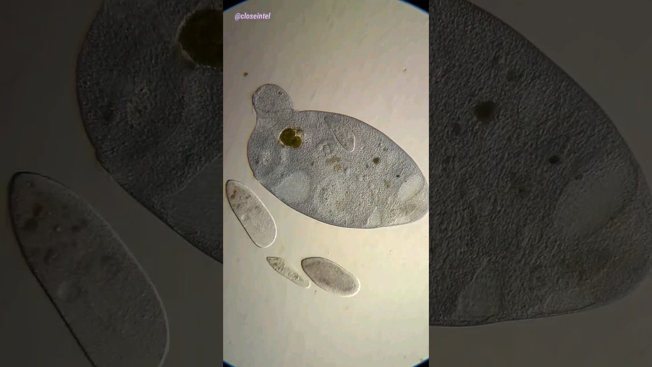 Cell Living Inside of Another Cell Under Microscope (Stentor and ...