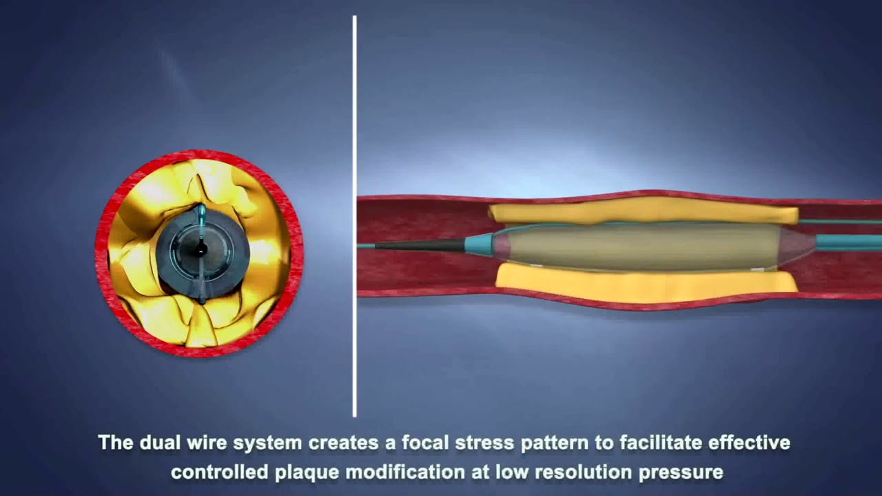 ScoreFlex Balloon - YouTube