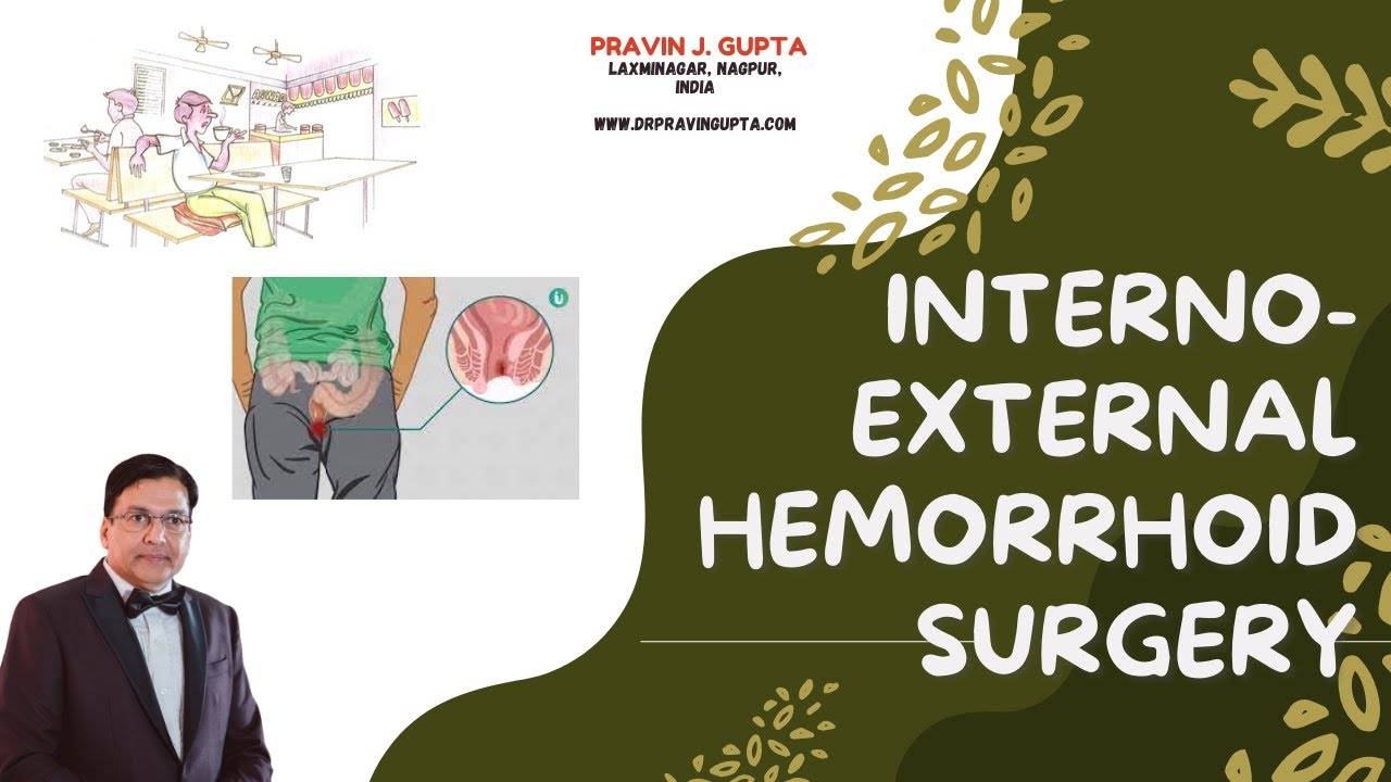 PROLAPSED THROMBOSED HEMORRHOIDS - YouTube