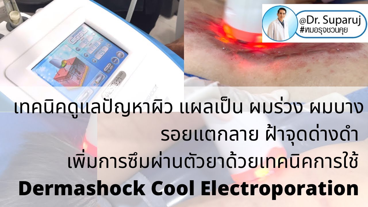 เทคนิคดูแลปัญหาผิว แผลเป็น ผมร่วง เพิ่มการซึมผ่านของตัวยาด้วย ...