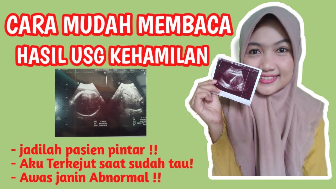 CARA MEMBACA HASIL USG KEHAMILAN | USG DOKTER KANDUNGAN - YouTube