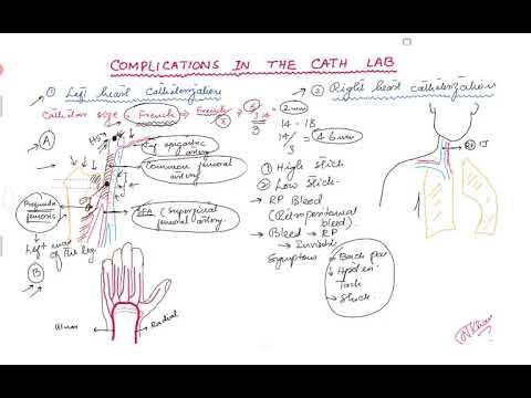 Vascular Complications in the Cath lab. - YouTube