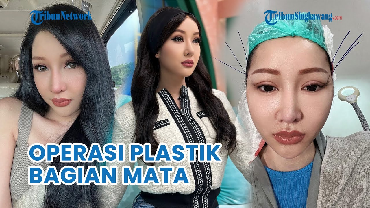 Penampilan Terbaru Lucinta Luna, Jalani Operasi Plastik Lagi - YouTube