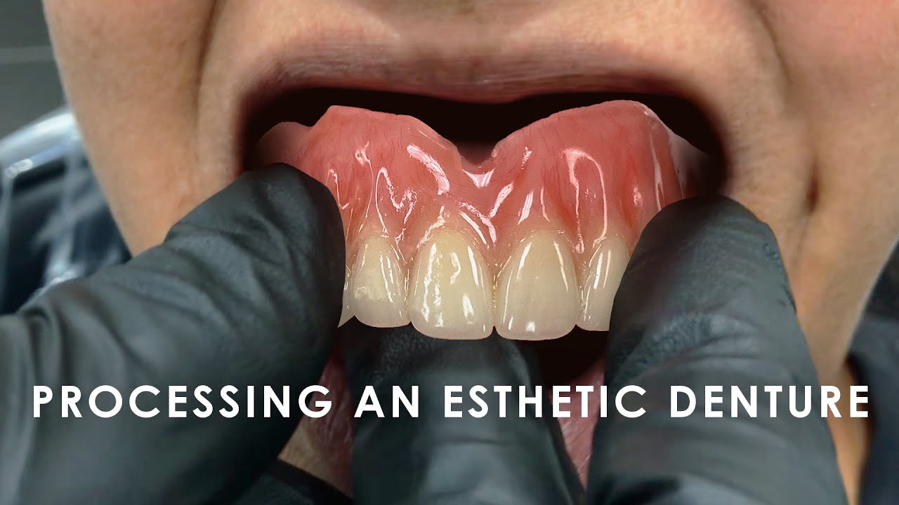 How to Process an Esthetic Denture - YouTube