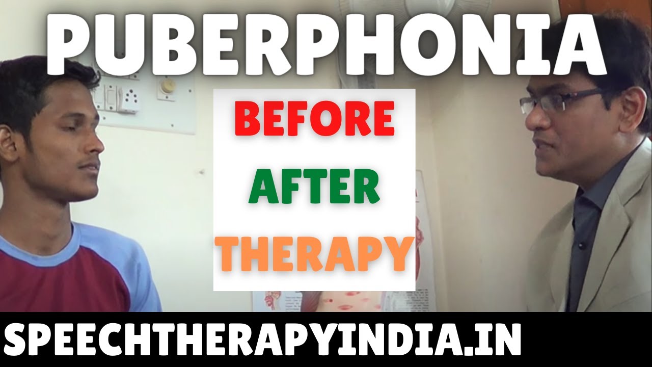 SLP Sanjay Kumar: Pre-Post Puberphonia Therapy || Within 8 Days ...