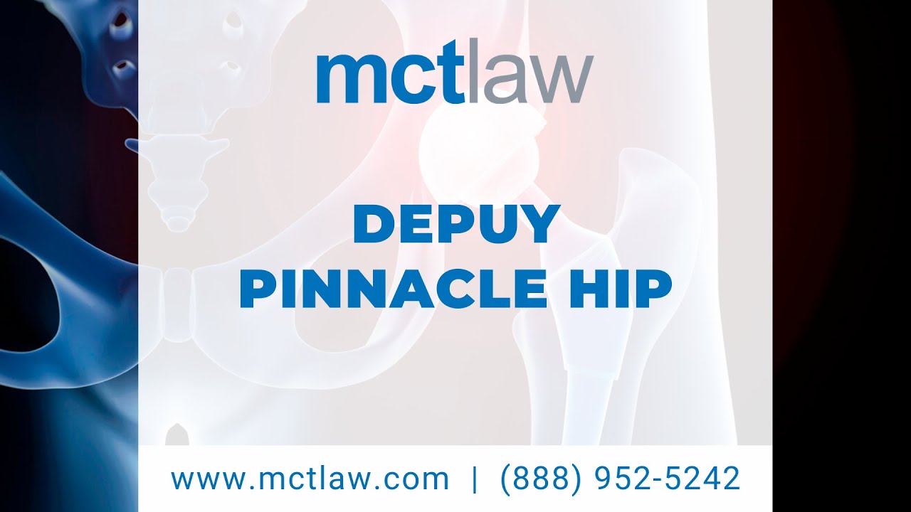 DePuy Pinnacle Hip Replacements - YouTube