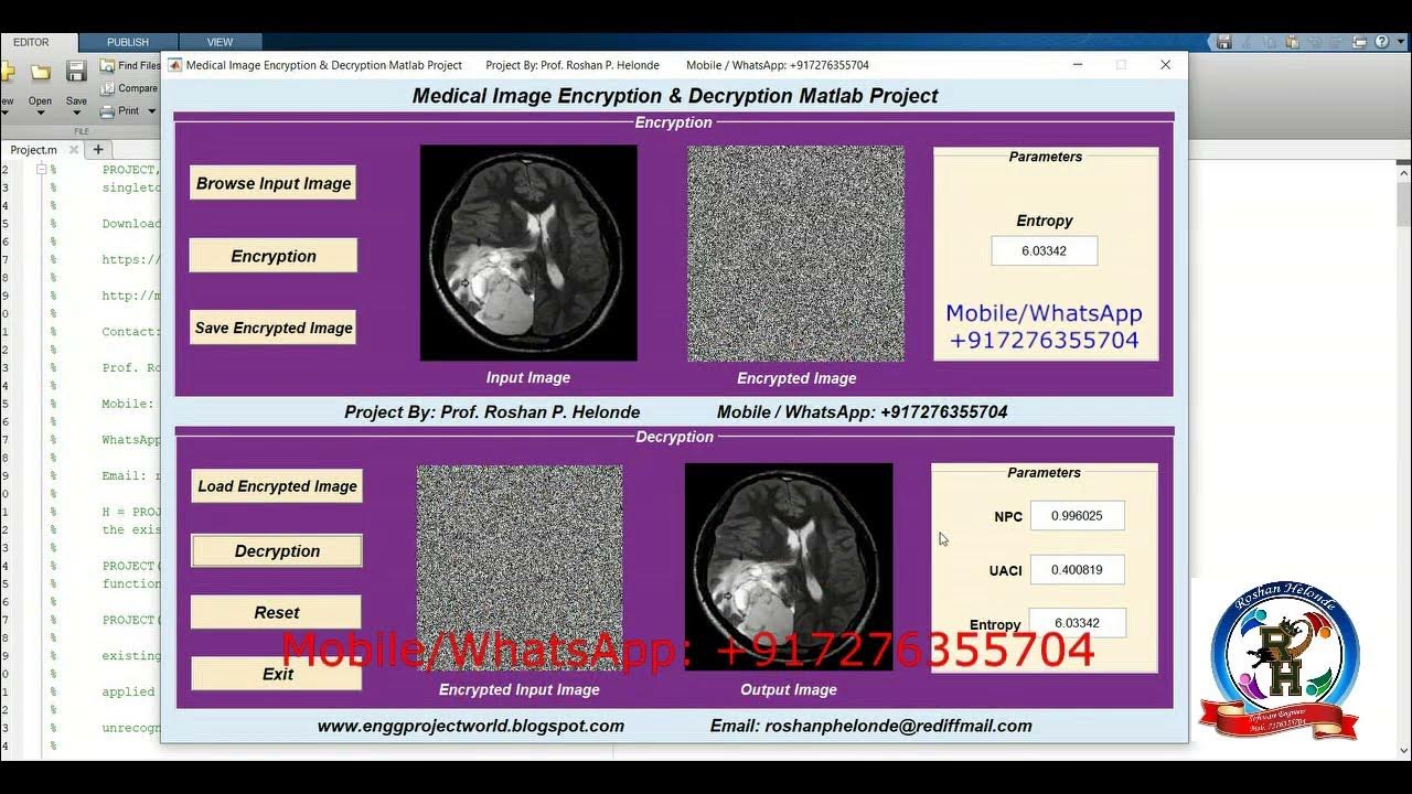 Medical Image Encryption and Decryption | With Source Code | Medical Image Encryption Matlab ...