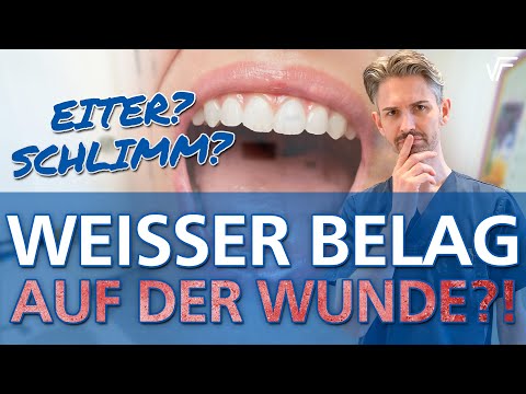 Weisser Belag auf meiner Wunde! Eiter? Entzündung? HILFE! 😣 - YouTube