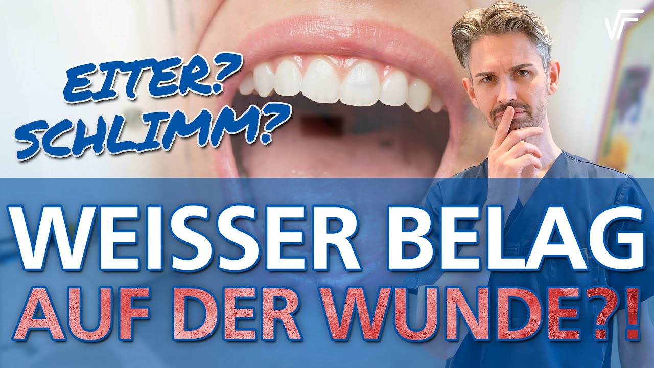 Eiter Und Geruch Aussagen: Wie Entsteht Eiter Beim Menschen – FDOMF