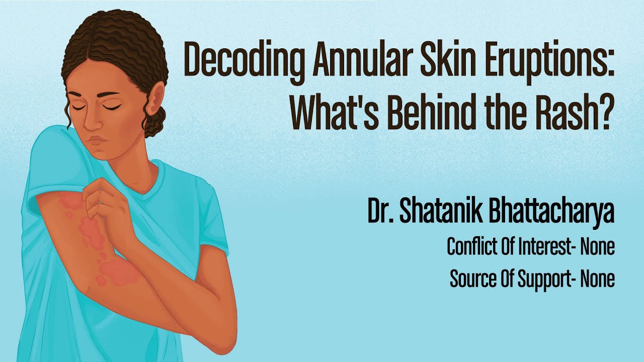 "Decoding Annular Skin Eruptions: What's Behind the Rash?" - YouTube