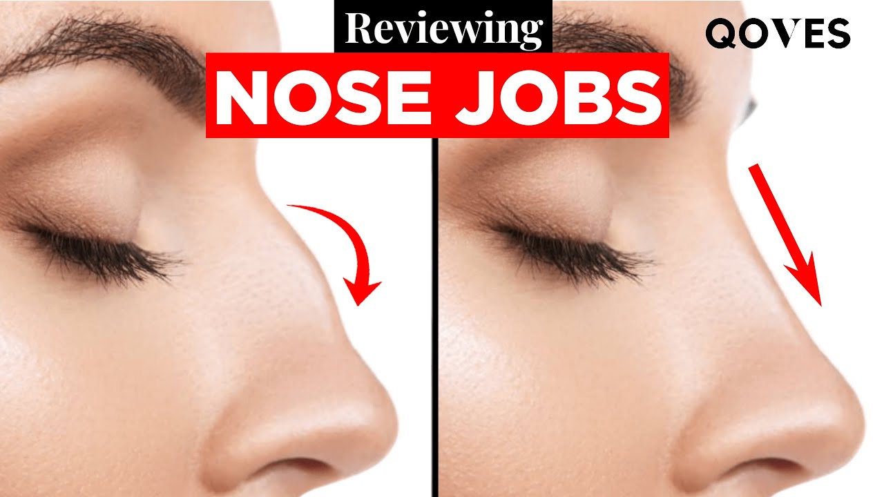 Some Of These Nose Jobs Are... - YouTube