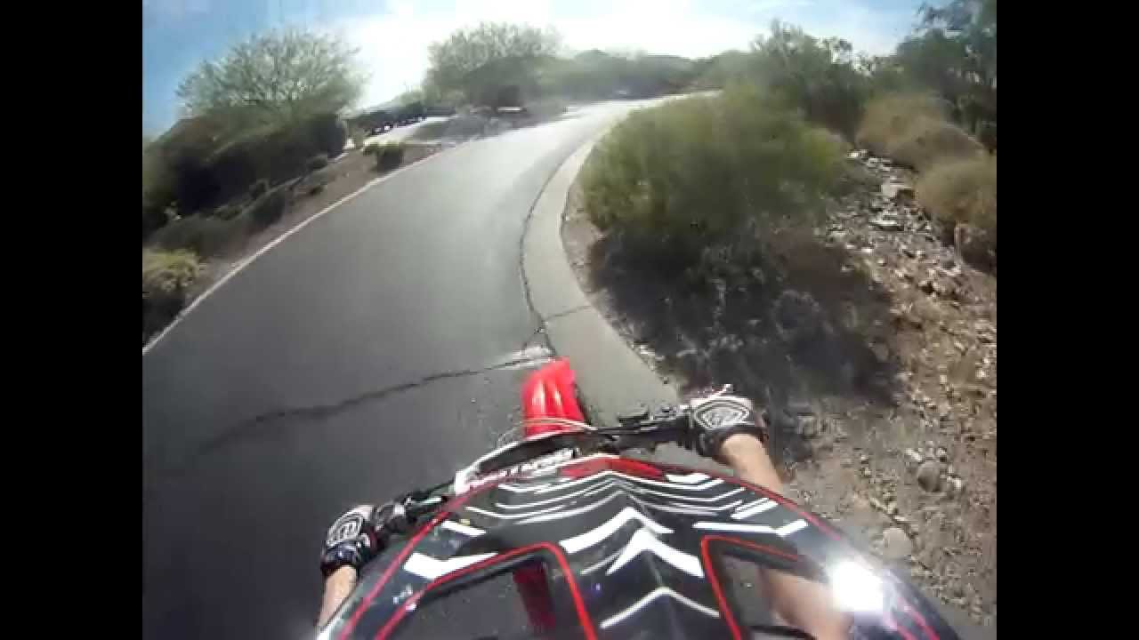 Dirt bike crashes aftermath broken leg & surgery part #2 - YouTube