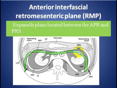 Radiology Rounds 027 Retroperitoneal Compartments - YouTube