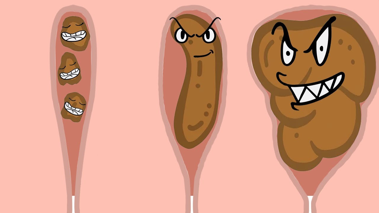 MAX LEVEL POOP in Tricky Brain? - YouTube