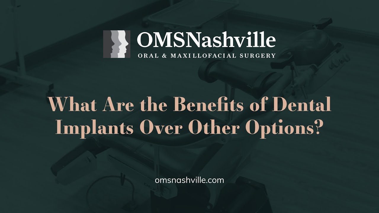 What Are the Benefits of Dental Implants Over Other Options? / OMS ...