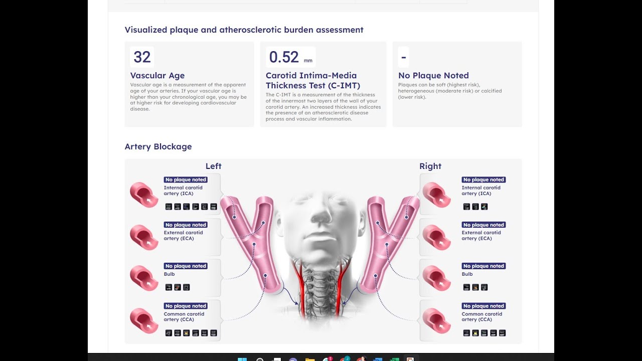 Patient education: Carotid IMT and Plaque assessment. - YouTube