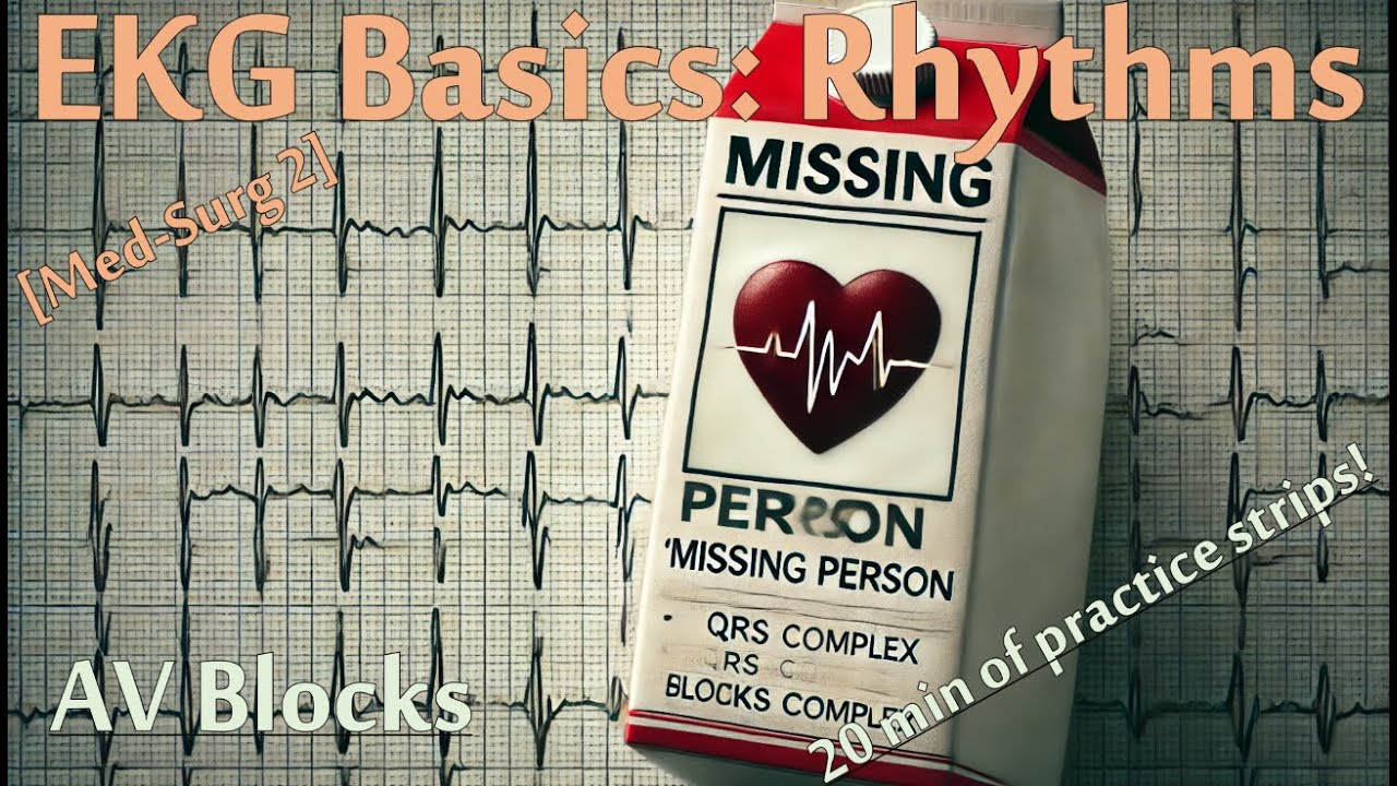 EKG Series [MedSurg2] Rhythms - AV Blocks (20min of practice questions ...