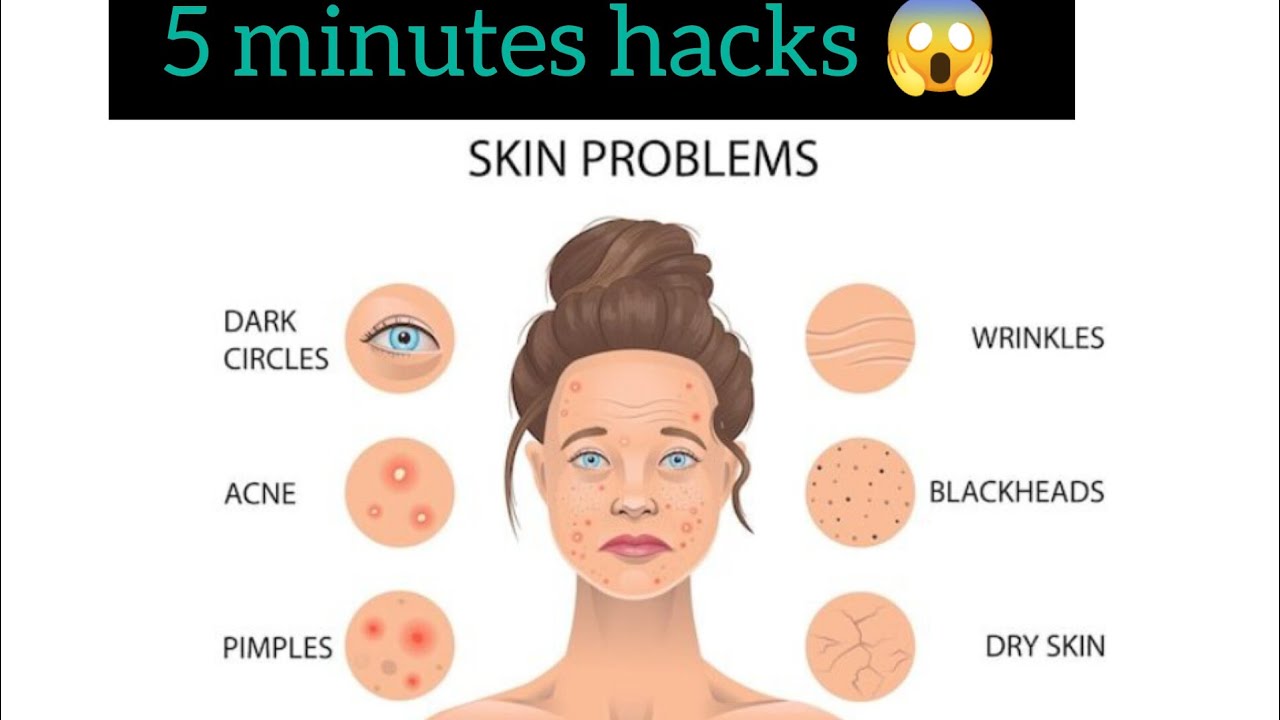 skin problem solution 100% guaranteed results 😱😱| @Beauty-hacks-salon ...