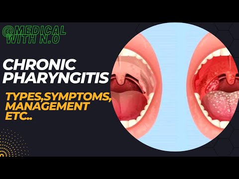 chronic pharyngitis, types, PATHOPHYSIOLOGY, TREATMENT , DIAGNOSIS, etc ...