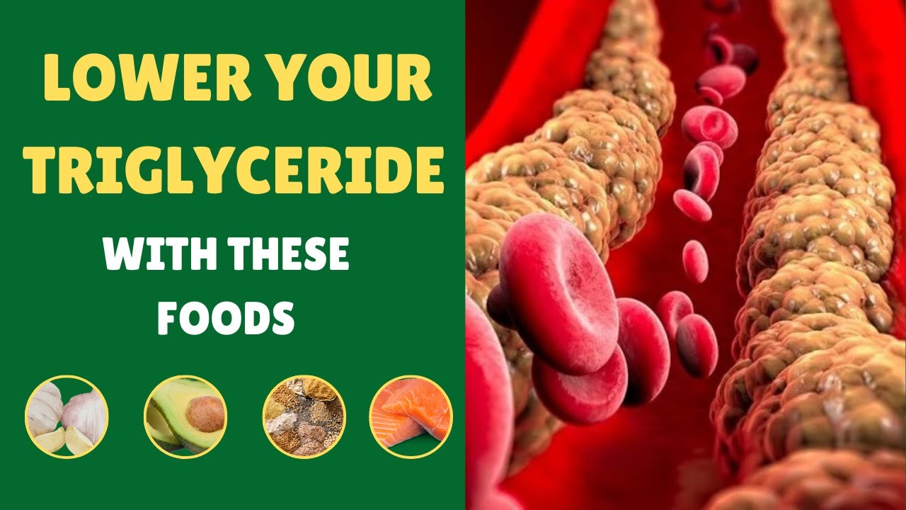 These are the Best Foods to Lower Your Triglyceride Levels [Fast ...