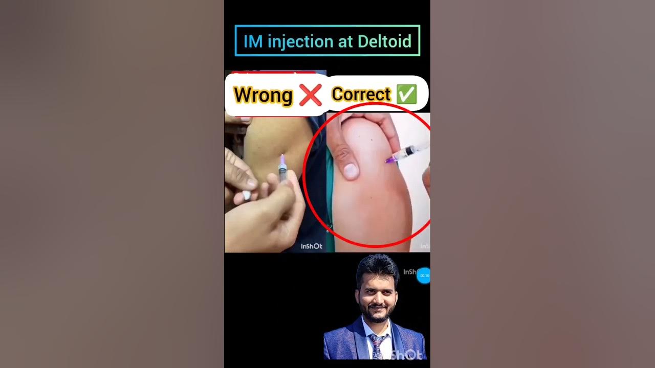 Deltoid IM injection #how to give intramuscular injection #shorts - YouTube