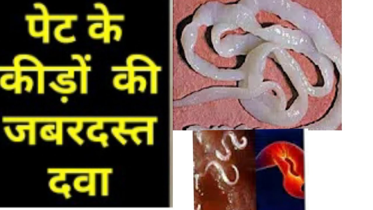 Actipar पेट के कीड़ों की सबसे अच्छी दवा Actipar syrup for Medicine news ...