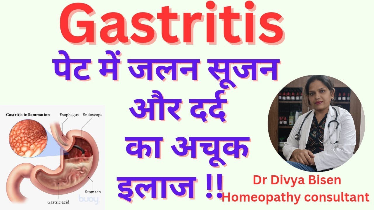 Gastritis treatment! Homeopathy medicine for Gastritis! Gastritis in ...