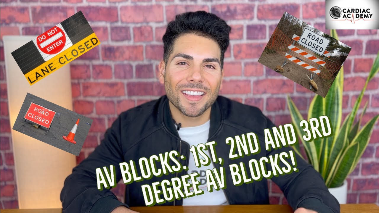 AV Blocks: 1st degree, 2nd degree and 3rd degree AV blocks! - YouTube