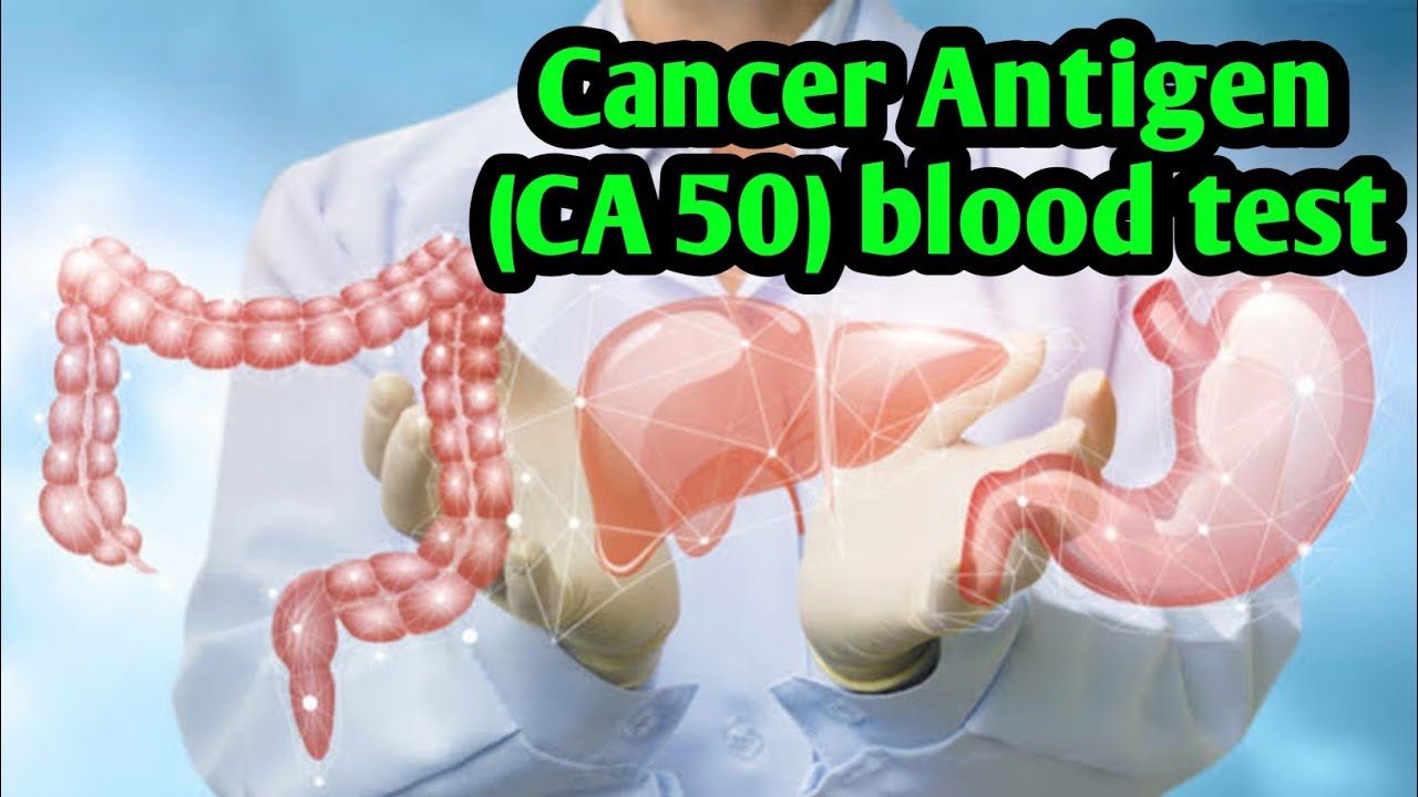 Cancer antigen (CA) 50 : tumor marker lecture 15 (F) - YouTube