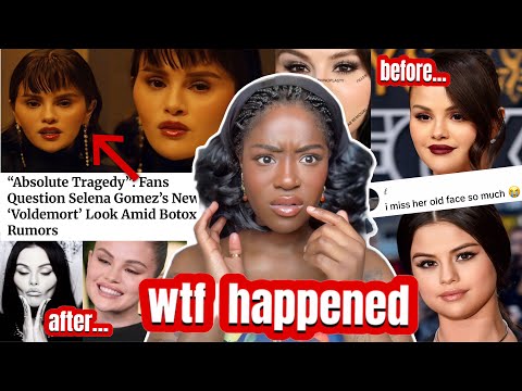 WTF has Selena Gomez done to her face.. *SHOCKING*