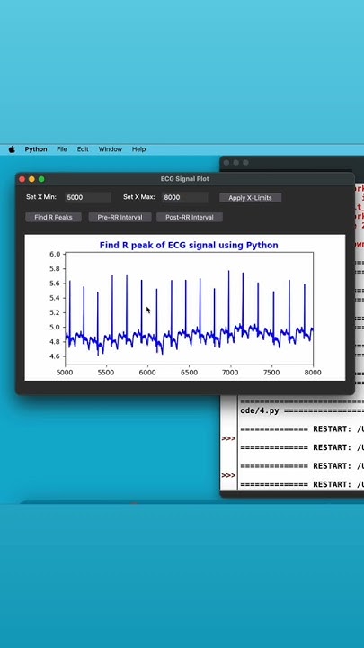R peak detection in ECG signal using python | Previous-RR Interval and Post RR Interval - YouTube