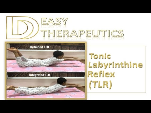 Tonic Labyrinthine Reflex