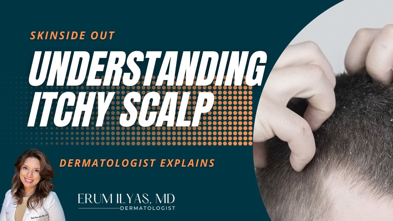 Itchy scalp | Skinside out - YouTube