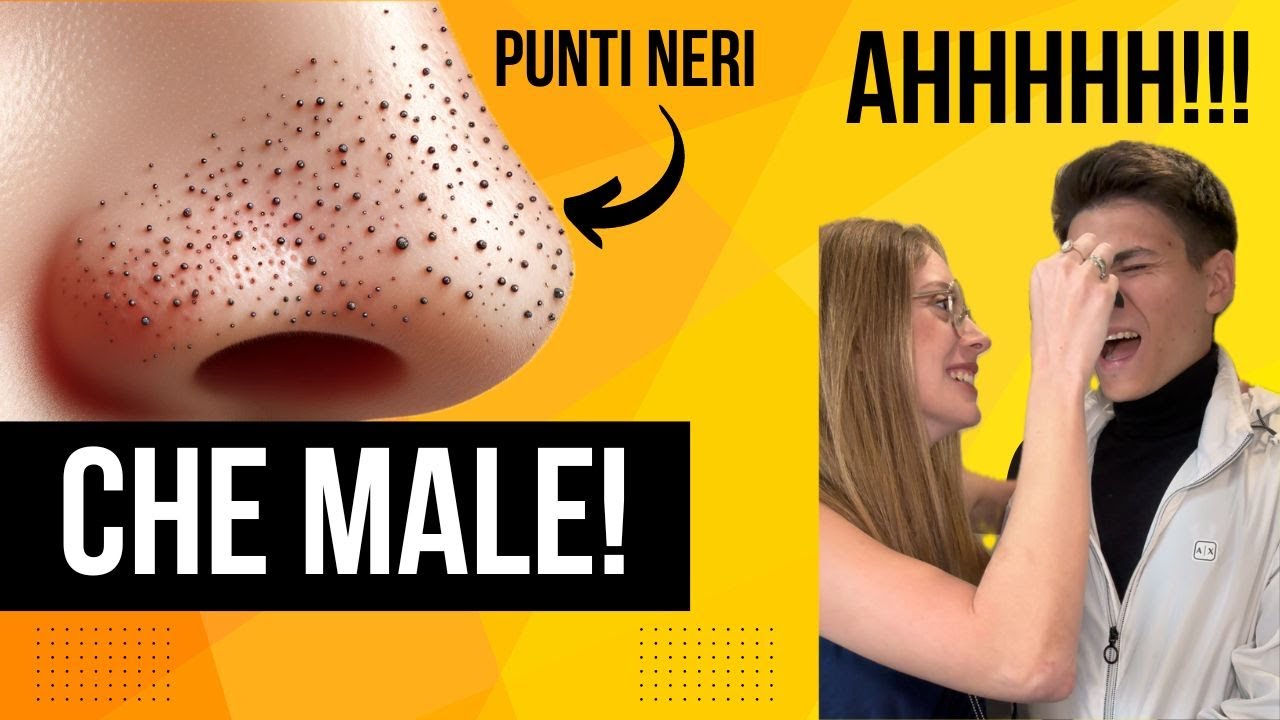 Tolgo i punti neri a mio marito! (AAAAH CHE MALE!😖) - YouTube