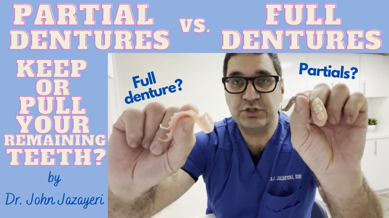 Partials vs. Full Dentures: Should You Keep or Remove Your Remaining ...