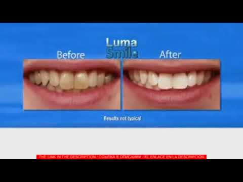 LUMA SMILE TOOTH POLISH & WHITENING - YouTube