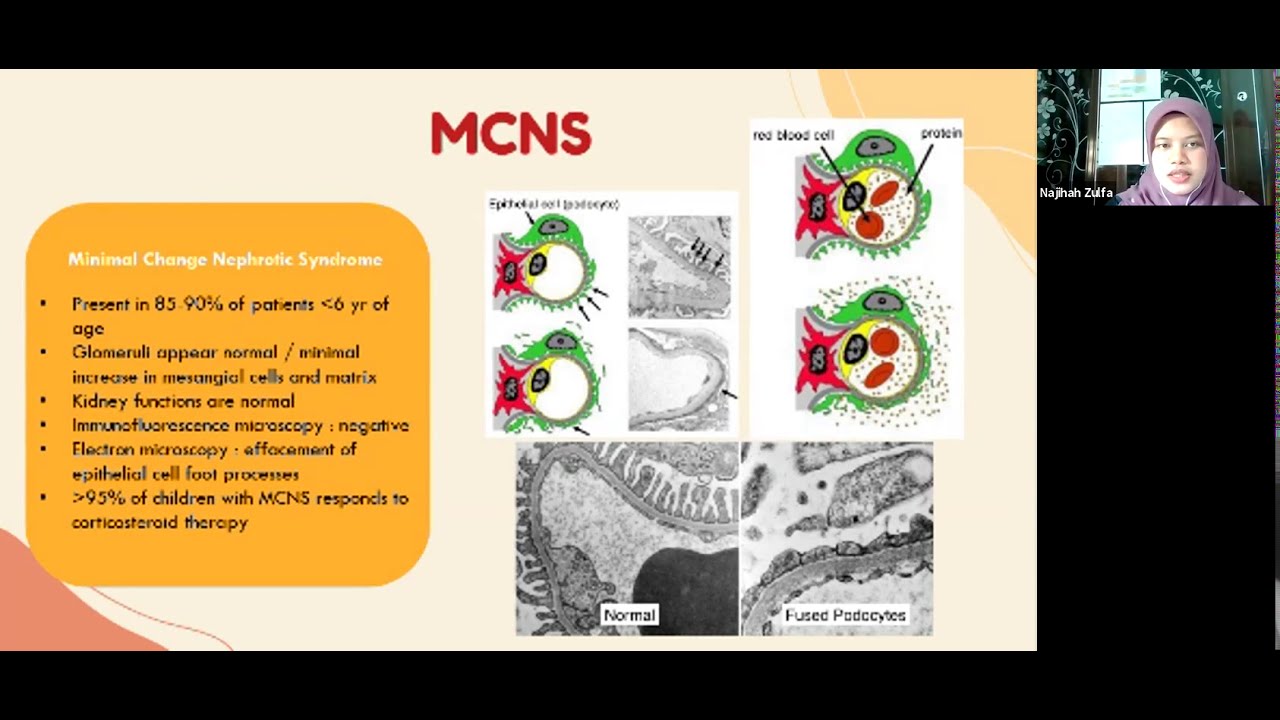 5.11.2020 Seminar 7 Nephrology with Dr. Mossad [Y3B1 20202021] - YouTube
