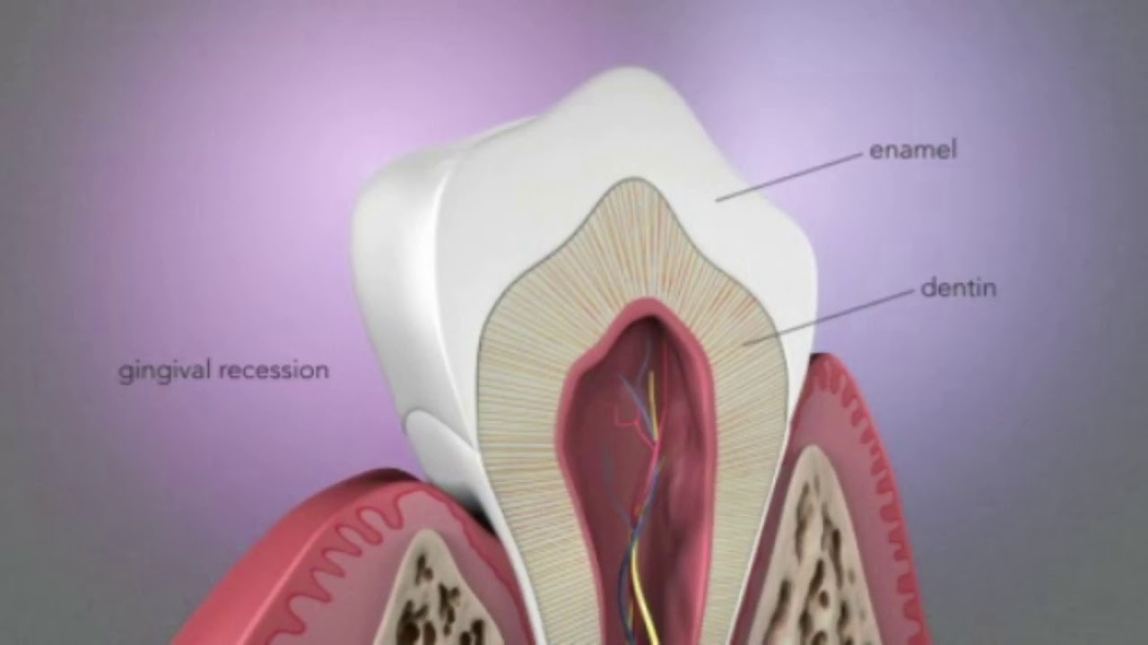 How it Works - Pro-Argin Technology for Sensitive Teeth - YouTube