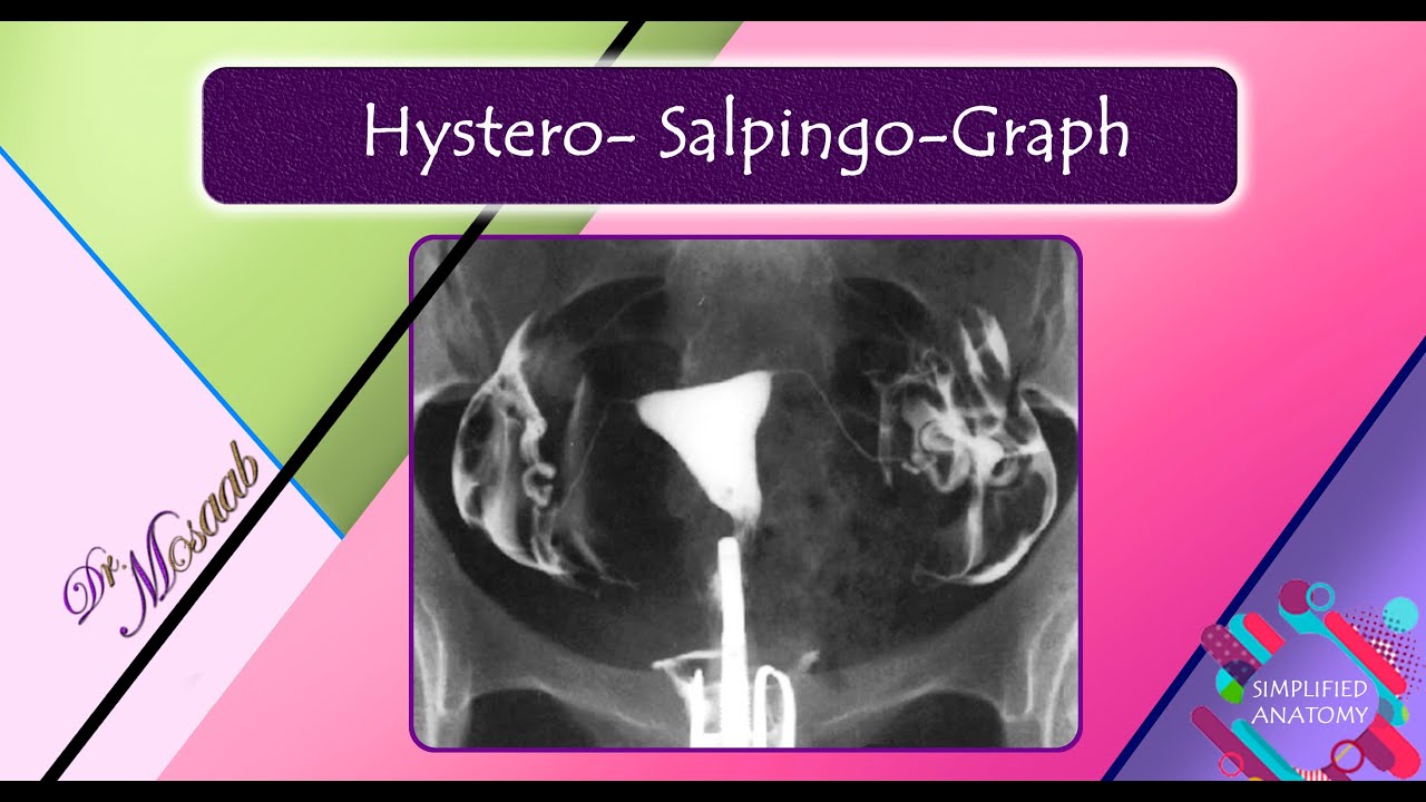 Radiological anatomy Hystero-salpingo-graph - YouTube