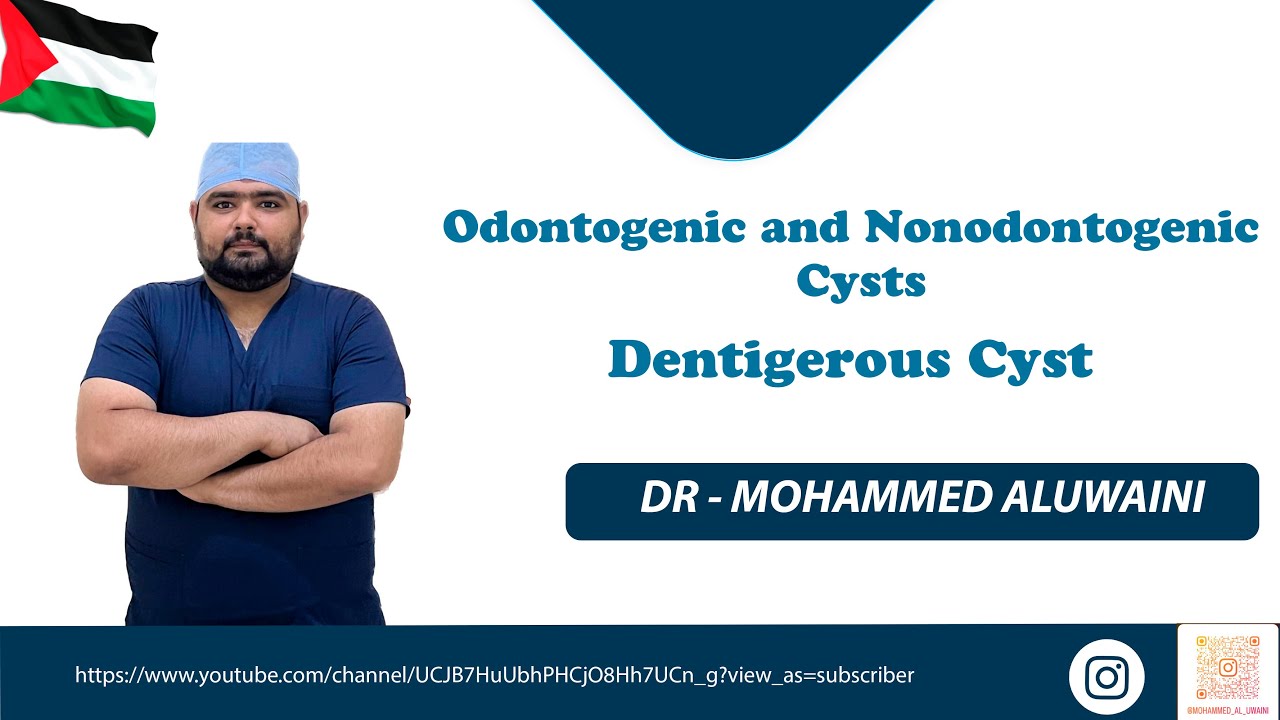 Dentigerous Cyst Youtube