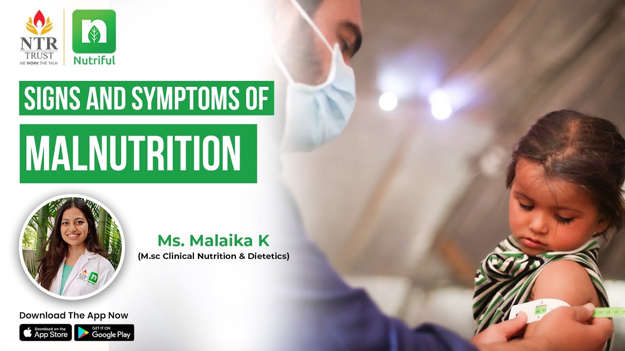 Signs And Symptoms Of Malnutrition - YouTube