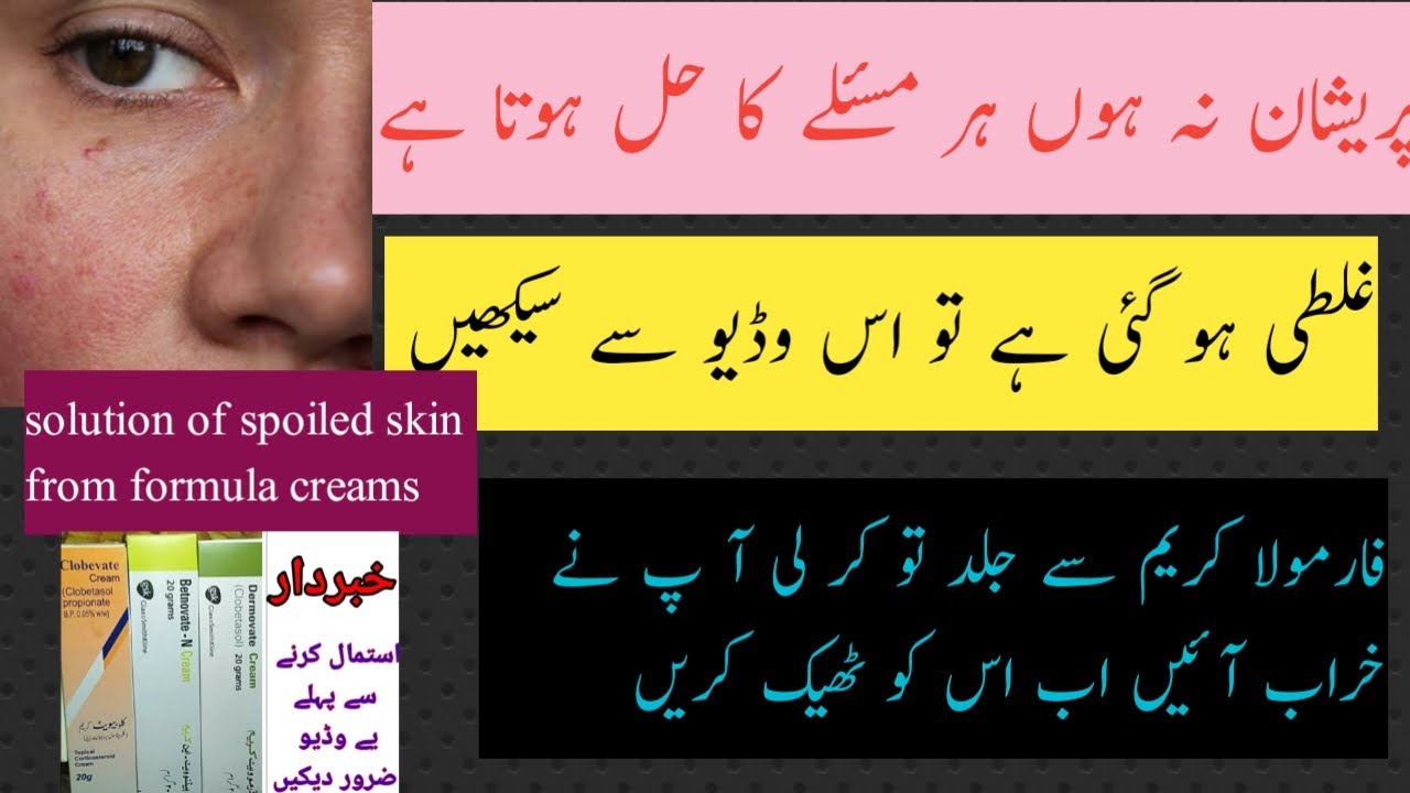 formula cream damage skin|farmulacrem kaise chordyn|steroids - YouTube
