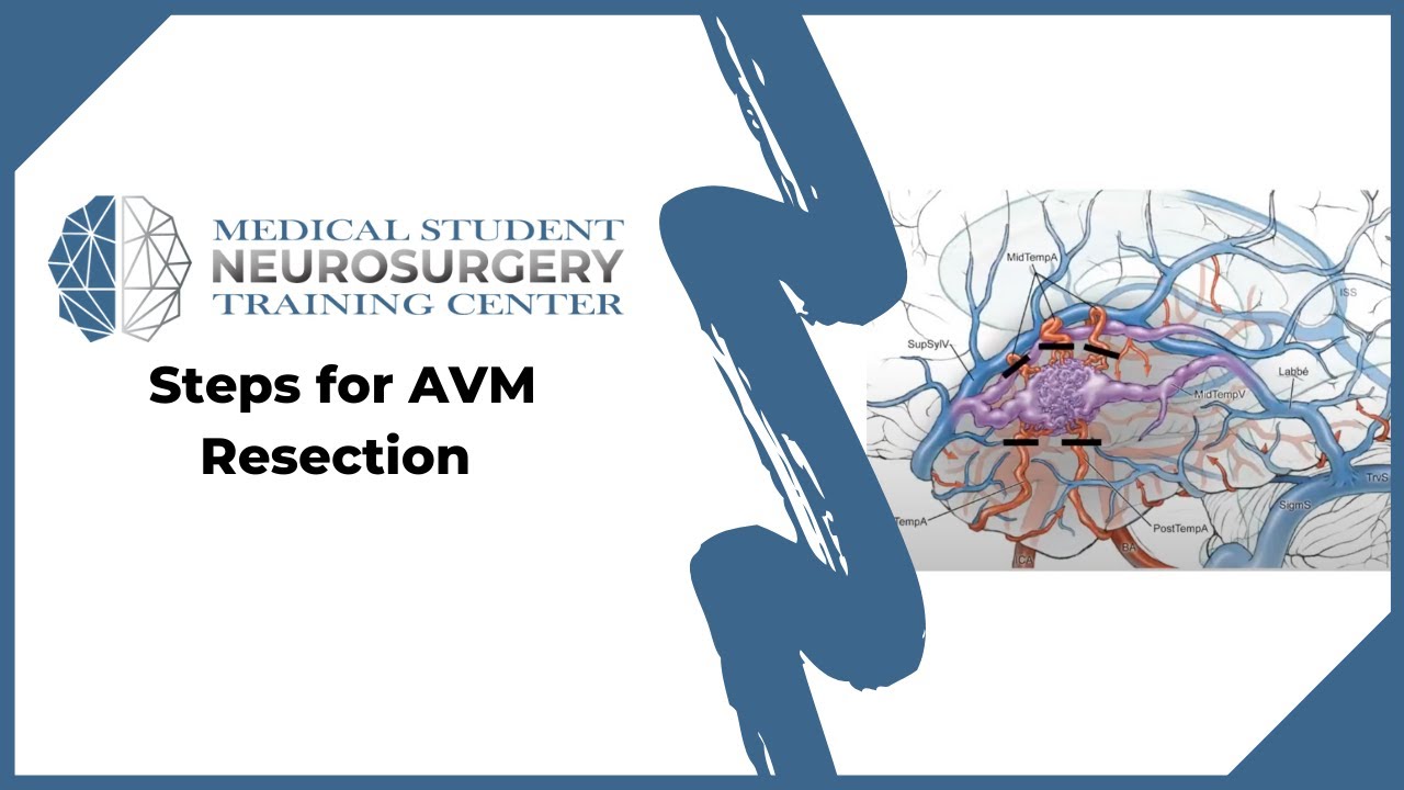 Steps for AVM Resection - YouTube