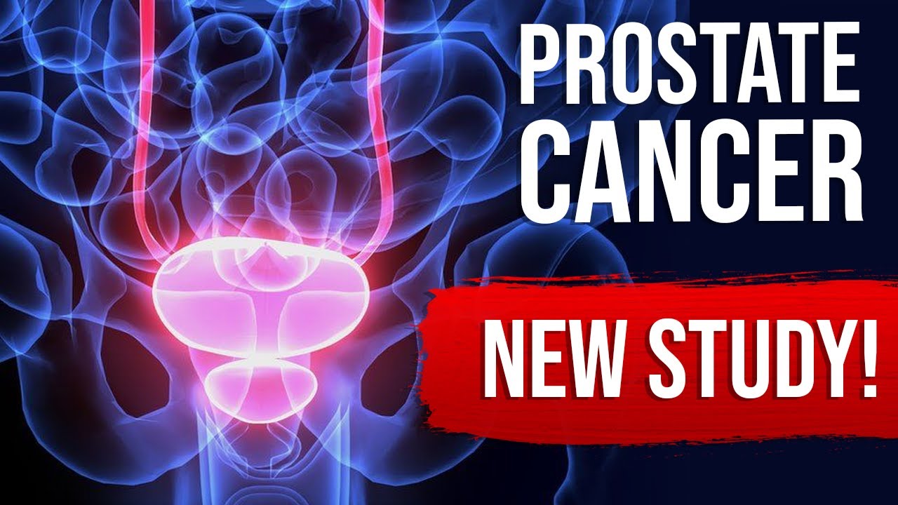 Prostate Cancer Latest Lifestyle Study (Reduce Your Prostate Cancer ...