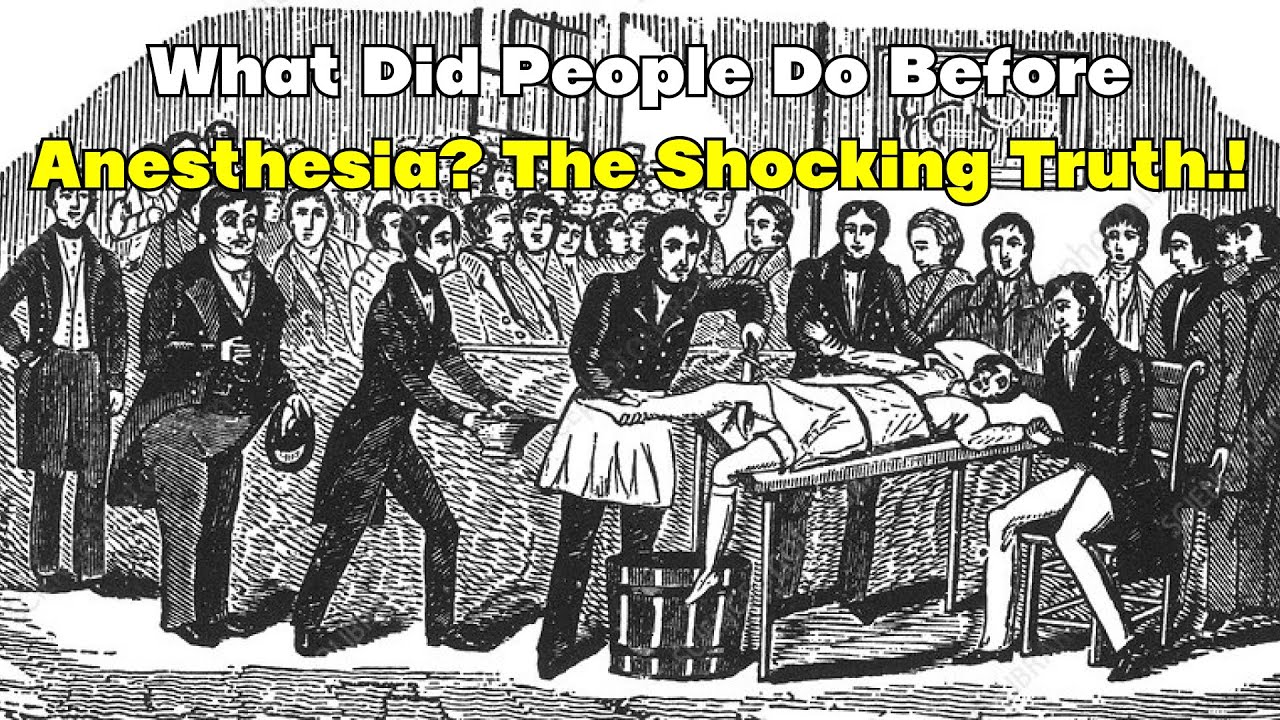 What Did People Do Before Anesthesia? The Shocking Truth! - YouTube