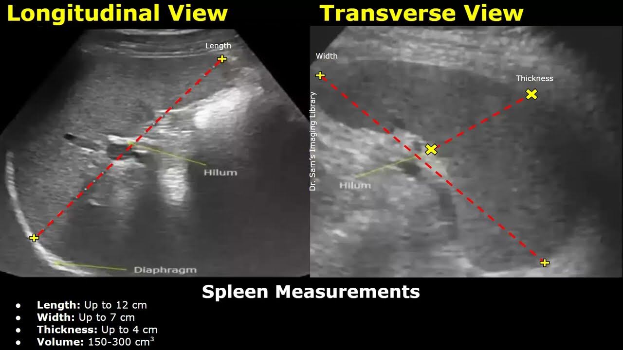 Normal Spleen Ultrasound Small Animal Abdominal Ultrasonography: The