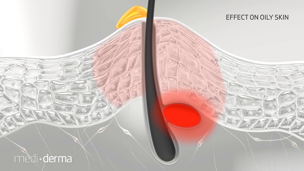 Video Peelings - YouTube