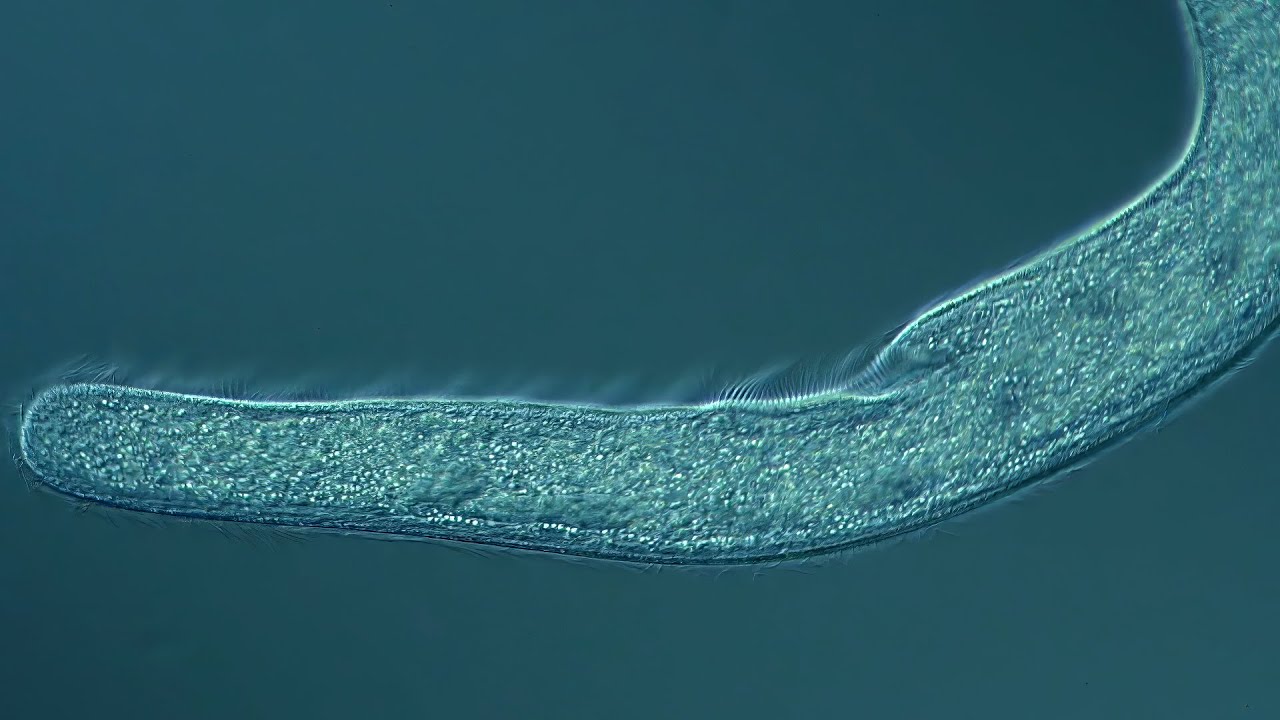 Spirostomum subtilis - YouTube