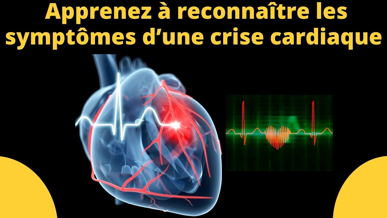 Infarctus :apprenez à reconnaître les symptômes d'une crise cardiaque ...